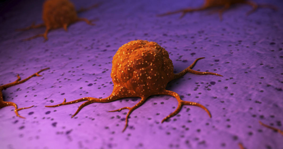 13 Early Warning Signs of Lupus You Need to Know (And What To Do The ...