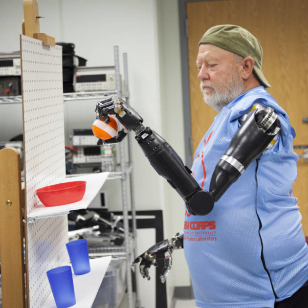 World First: Double Amputee Controls Two Prosthetic Arms With His Thoughts