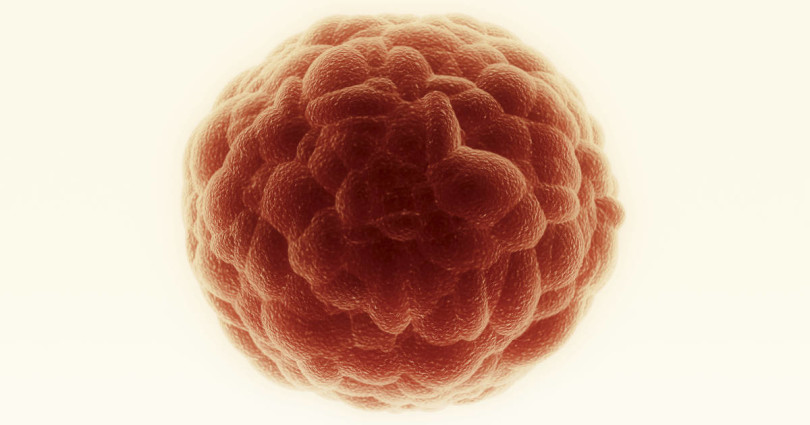 New Evidence Found That Vitamin D Shuts Down Cancer Cells