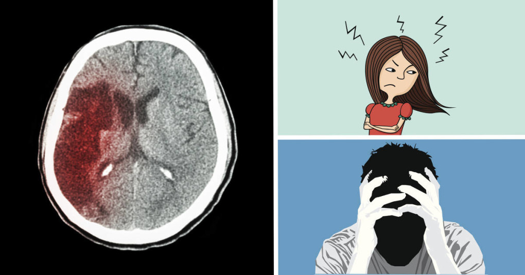 3 Emotions That Raise Your Risk Of Stroke