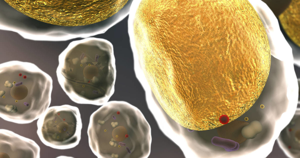 The Perfect Exercise To Fix Poor Body Posture