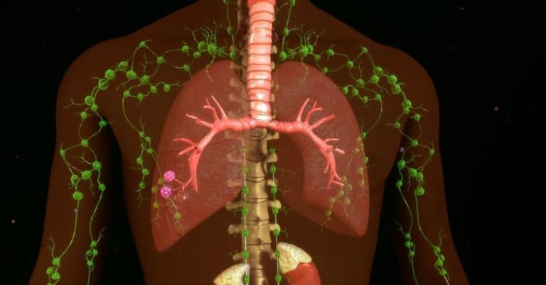 7 Easy Ways To Quickly Unclog Your Lymph Nodes To Reduce Swelling And ...