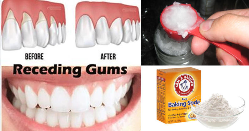 Marijuana Chewing Gum And 14 Other Natural IBS Treatment Options