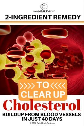 2-Ingredient Remedy To Clear Up Cholesterol Buildup From Blood Vessels ...
