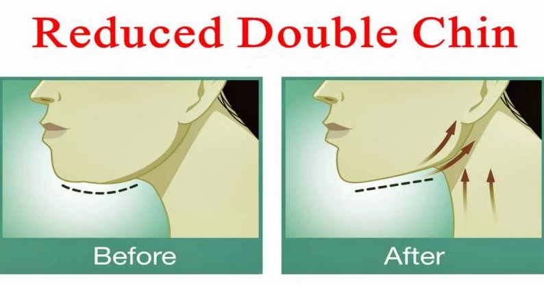 How To Get Rid Of A Double Chin And Neck Fat - DailyHealthPost