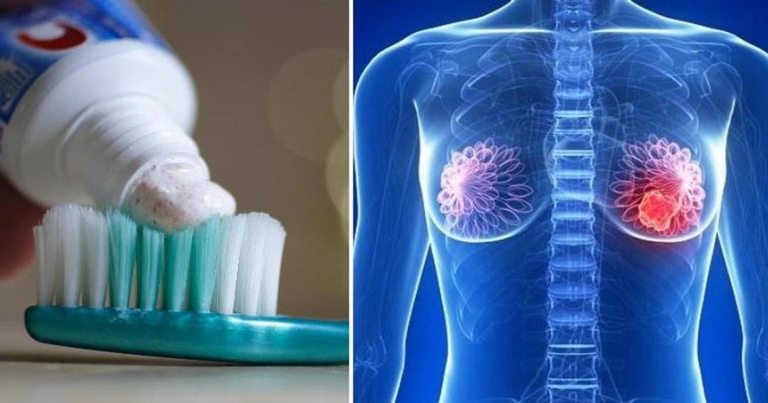 Beware: This Common Ingredient In Toothpaste Causes Cancer And Liver ...