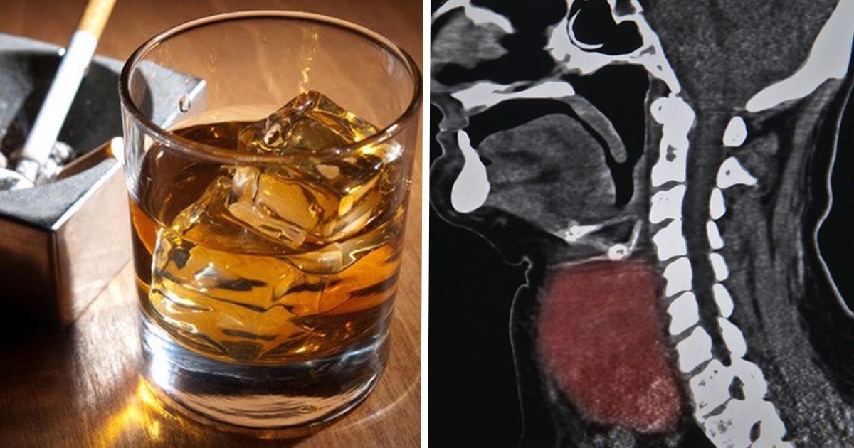 Link Between Alcohol And Cancer Can No Longer Be Denied