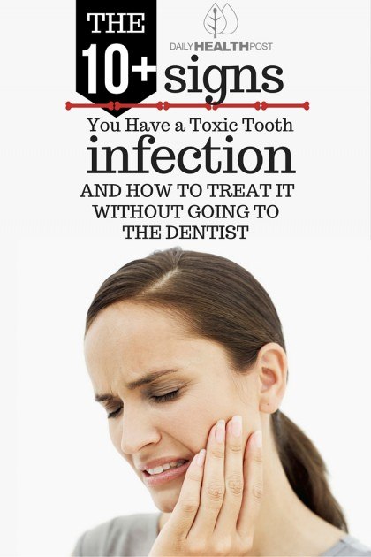 10+ Signs You Have A Toxic Tooth Infection And How To Treat It