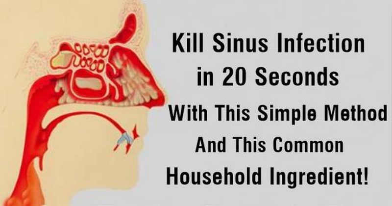 Get Sinus Congestion Relief In 20-Second With This Simple Method