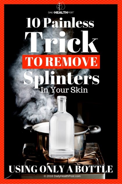 Painless Trick To Remove Stubborn Splinters In Your Skin Using Only A ...