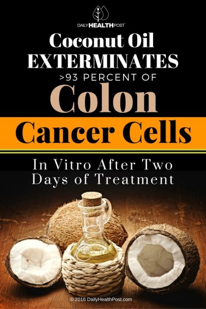 Coconut Oil Exterminates >93 Percent of Colon Cancer Cells In Vitro ...
