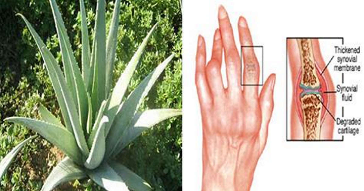 Herbs And Essential Oils For Arthritis: Manage Your Symptoms Naturally