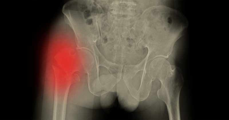 Prednisone Side Effects: The Bad & The Ugly Of Anti-inflammatory Drugs