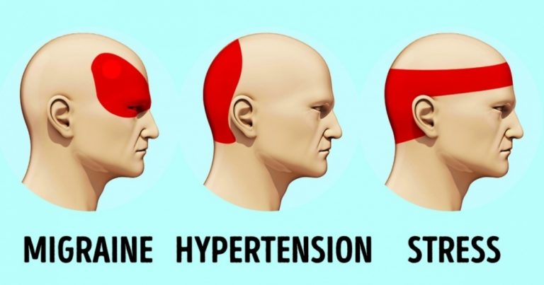 6 Pressure Points For Headaches That Provide Relief In Just 5 Minutes