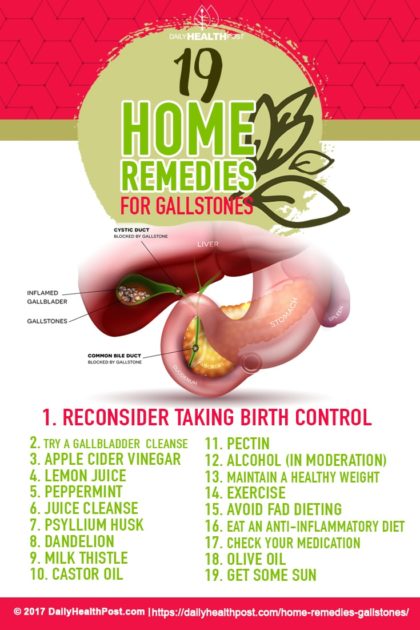 19 Home Remedies For Gallstones Your Body Will Love