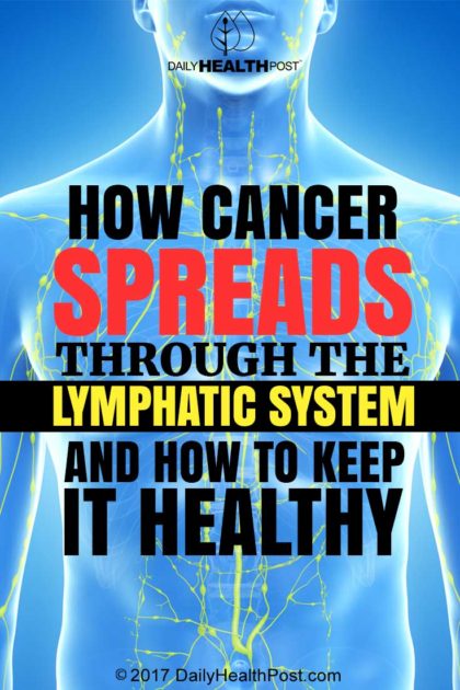 The Tumor Highway: Cancer And The Lymphatic System