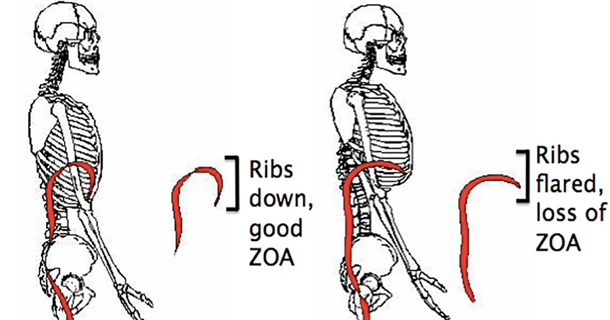 9 Best Exercises To Correct Flared Ribs Without Surgery 9 Best Exercises To Correct Flared Ribs Without Surgery