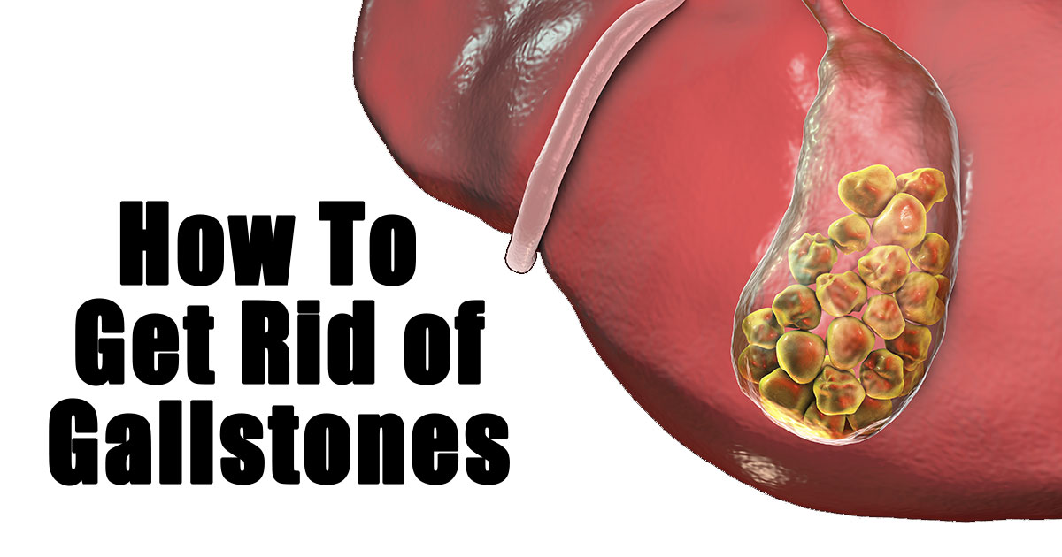 19 Home Remedies For Gallstones Your Body Will Love