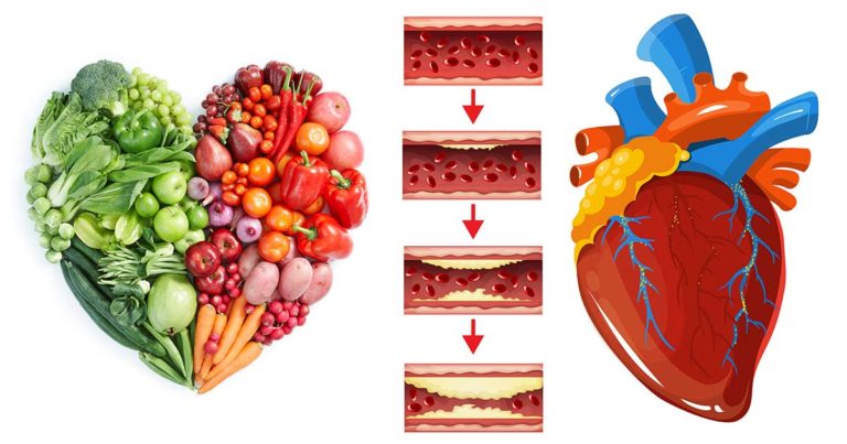 15 Nutrients That Help Prevent Coronary Heart Disease