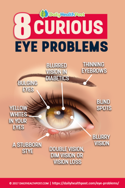 8 Eye Problems That May Actually Indicate Disease