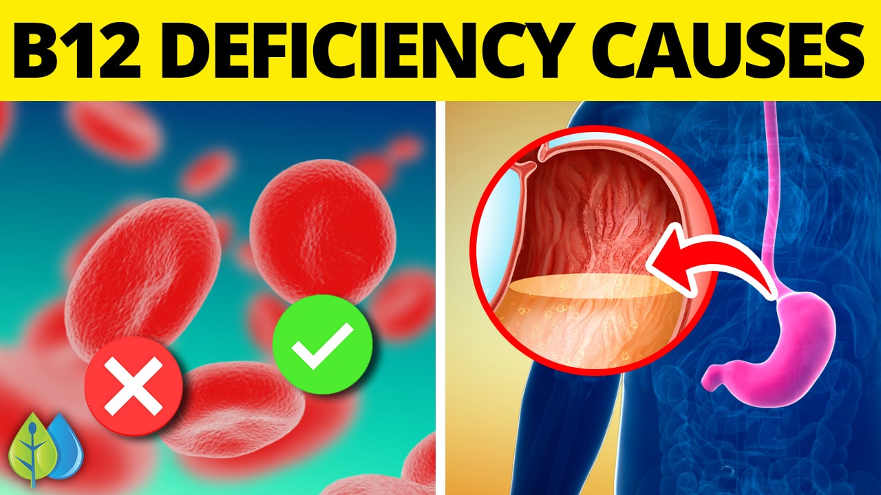 Top 8 Causes Of Vitamin B12 Deficiency