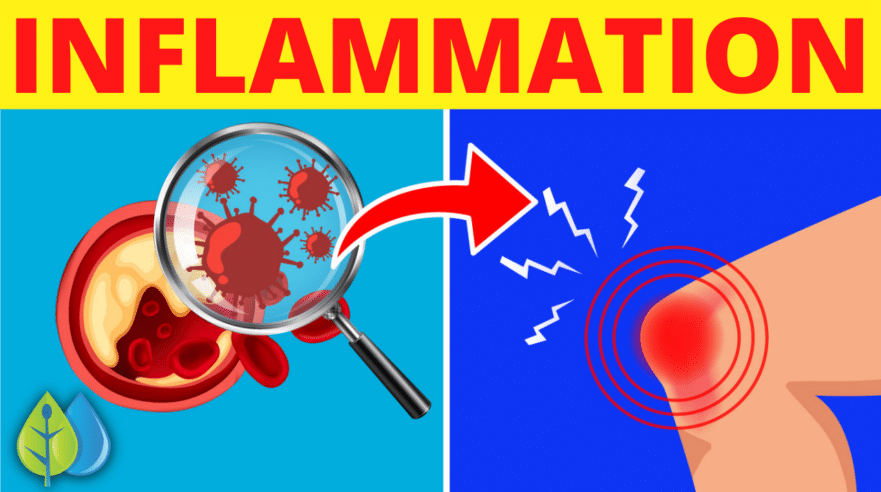 Top 16 Essential Oils For Inflammation You Can Use At Home