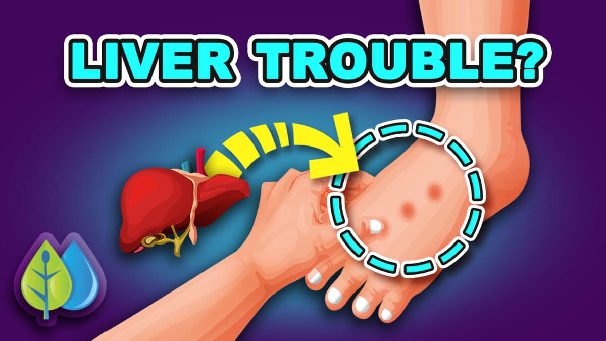 These Are 5 Symptoms Of Liver Problems Your Legs REVEAL