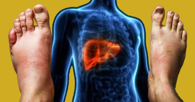 4 Things Your Feet Could Be Telling You About Your Liver Health