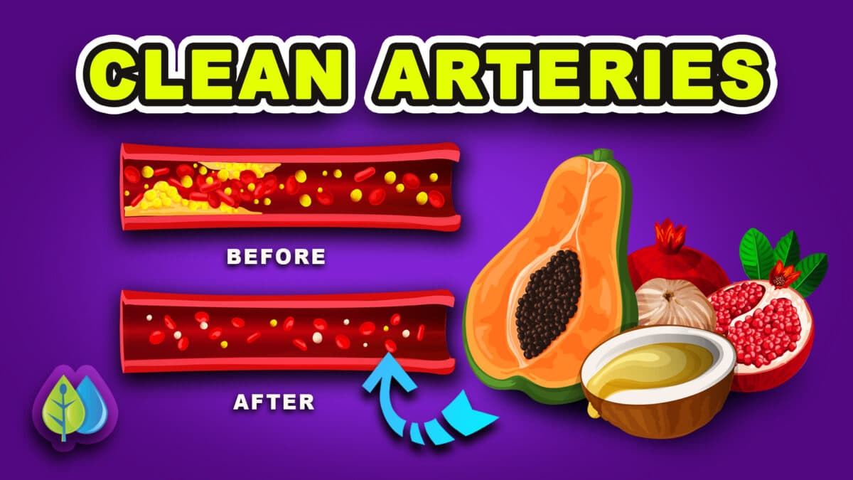 Top 10 Foods That Unclog Arteries Naturally And Prevent Heart Attack