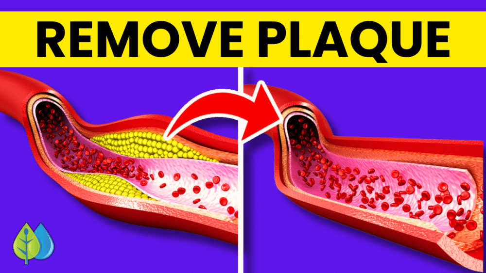 How To Cleanse Your Arteries With Only 3 Ingredients