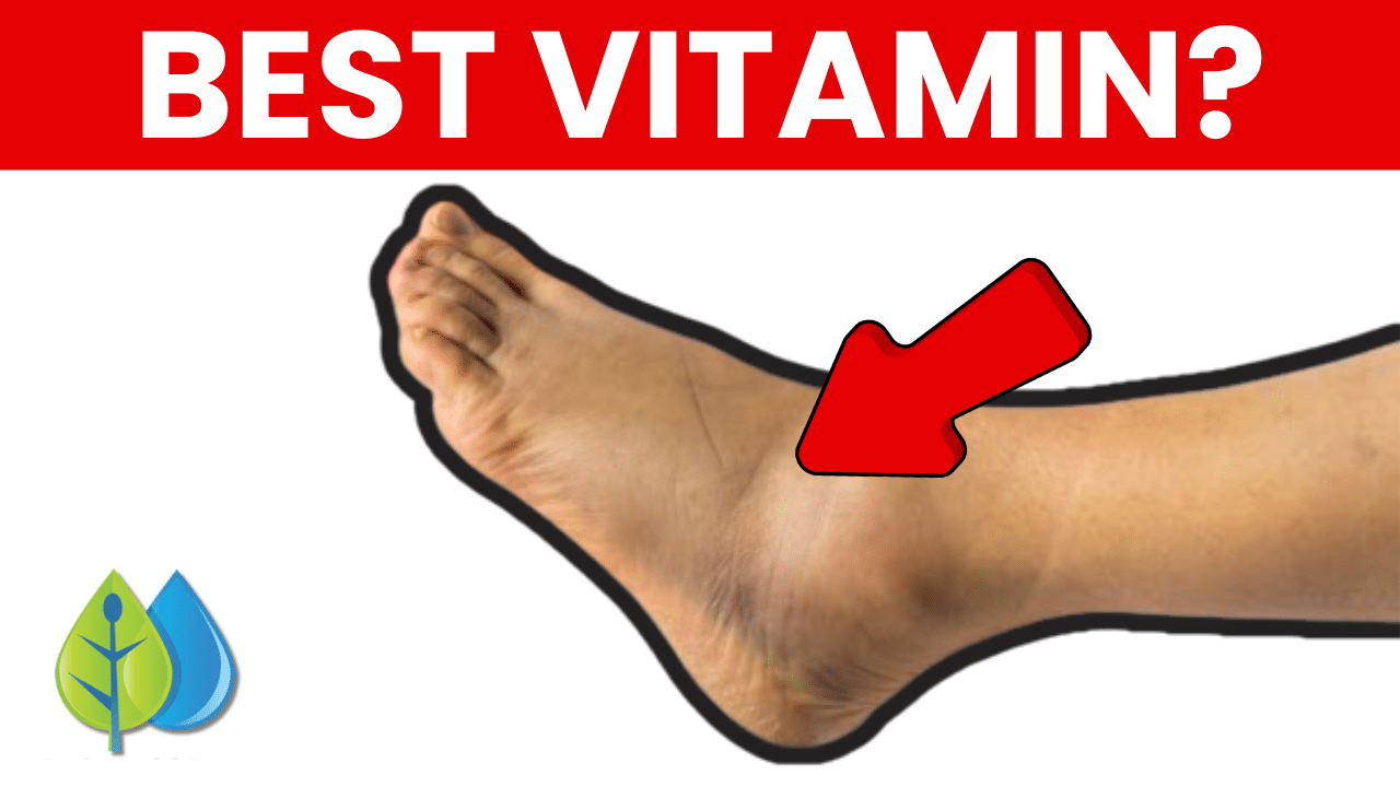 Top 5 Nutrients To Reduce Swelling In Feet And Legs