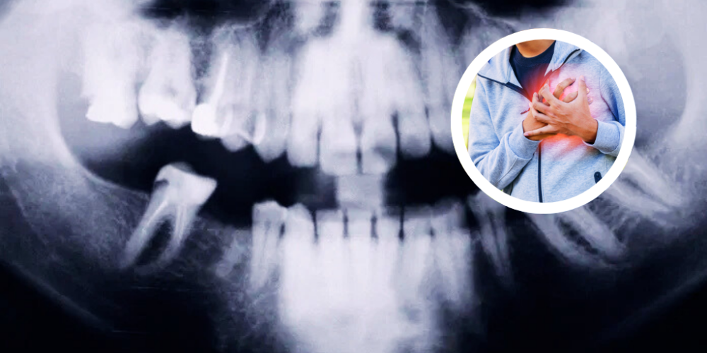 Losing Teeth Could Raise Your Risk Of Deadly Heart Disease, New Study Warns