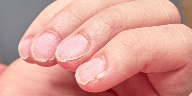 Vertical Nail Ridges? Here’s What Causes Them — And How To Fix It
