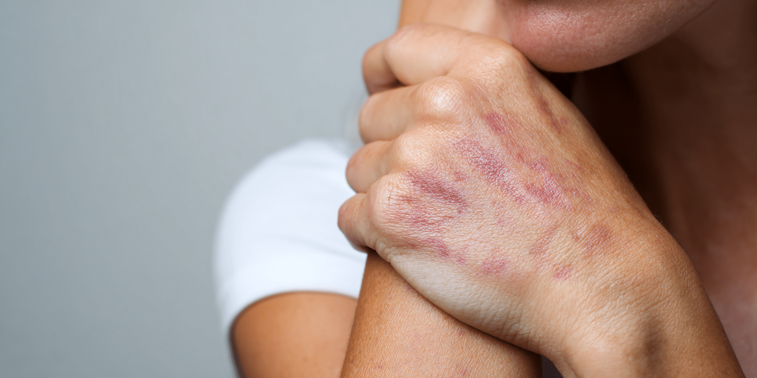 Rub Magnesium Oil On Your Feet Before Bed What Happens Overnight Will