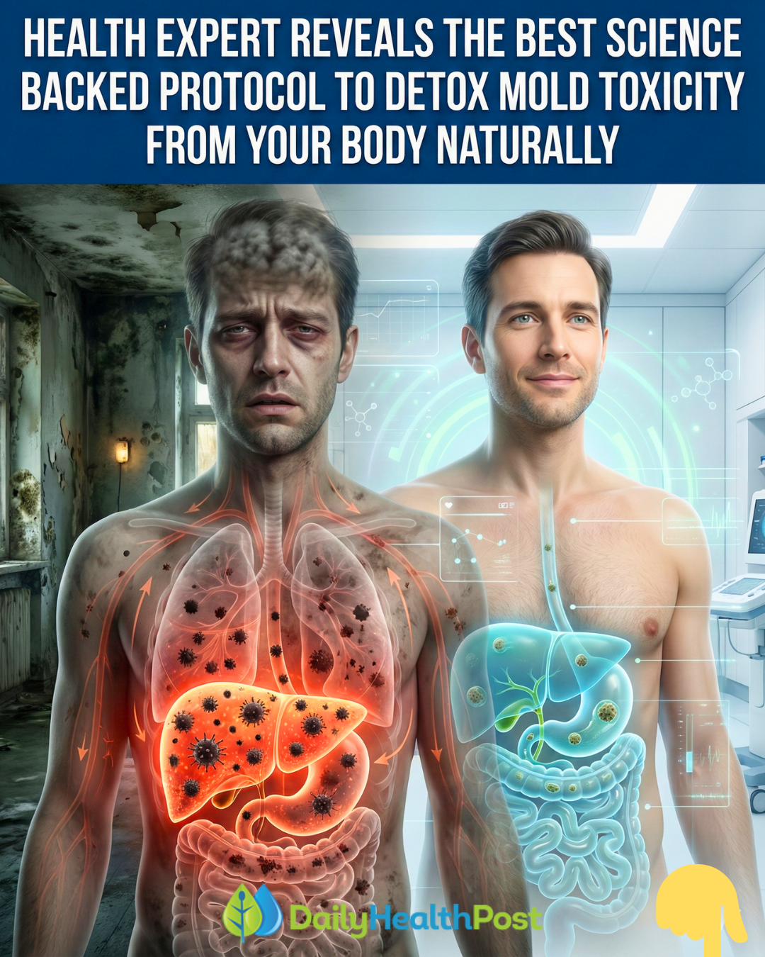 Health Expert Reveals The Best Science Backed Protocol To Detox Mold ...